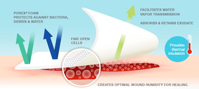 Patient Positioning Foam - Open-cell Foam Technology
