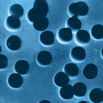 Track-Etched Membrane Technology | Porex